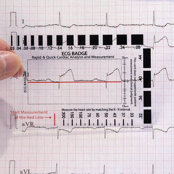 Personalized ECG EKG Rhythm Analysis Tool Acrylic Badge Card with Title ...